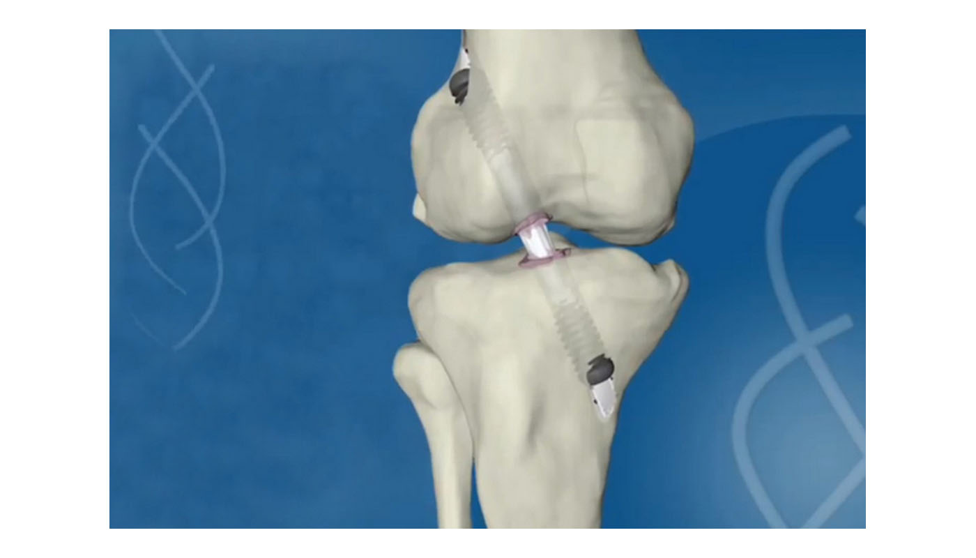 UConn scientist working on a new way to repair knees