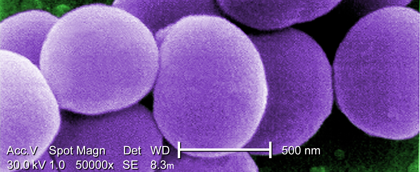 CDC budget cuts threaten the fight against 'superbugs'