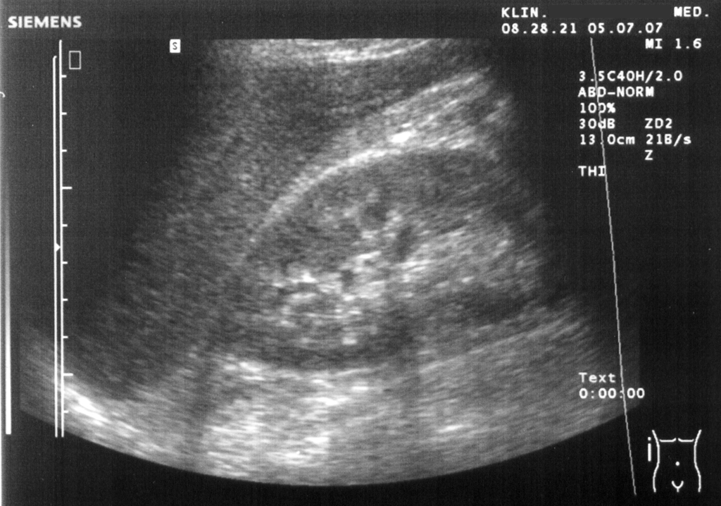 ultrasound-fetus | CT Mirror